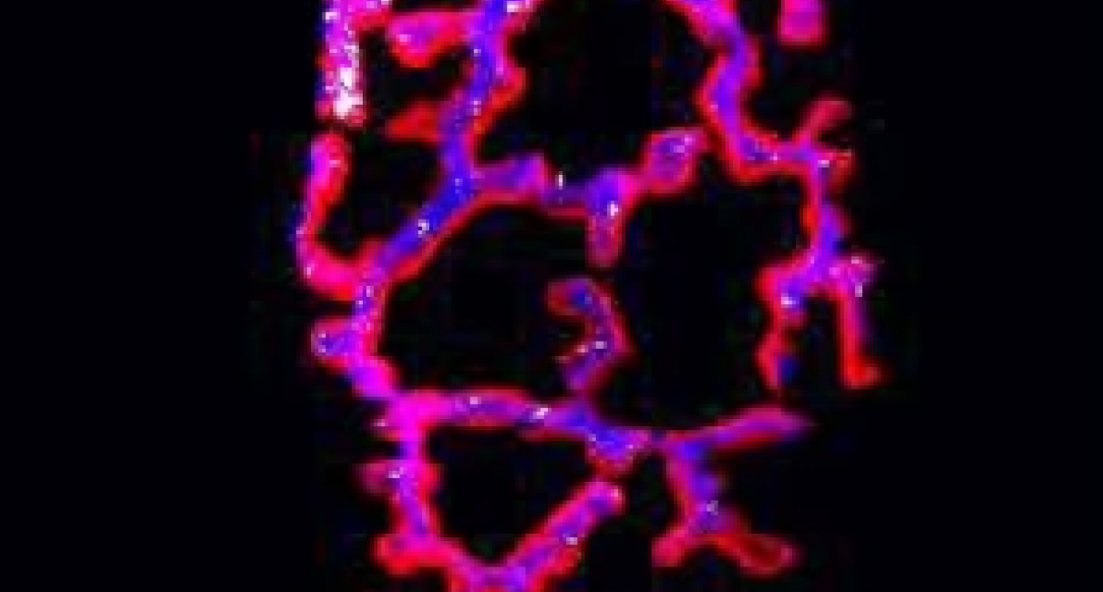 Breakthrough in ALS: RNA Therapy Opens New Avenue for Treatment | Sagol ...