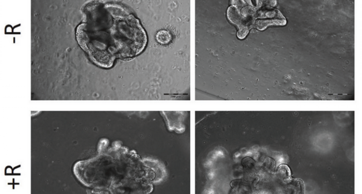 Rapamycin Enables Differentiation Rescue in APC‑Mutant Colon Organoid ...